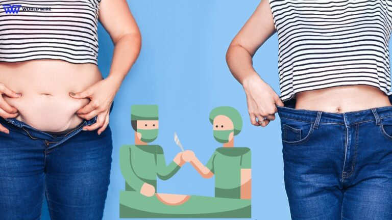 Free Excess Skin Removal Surgery: How & Top 5 Places - World-Wire